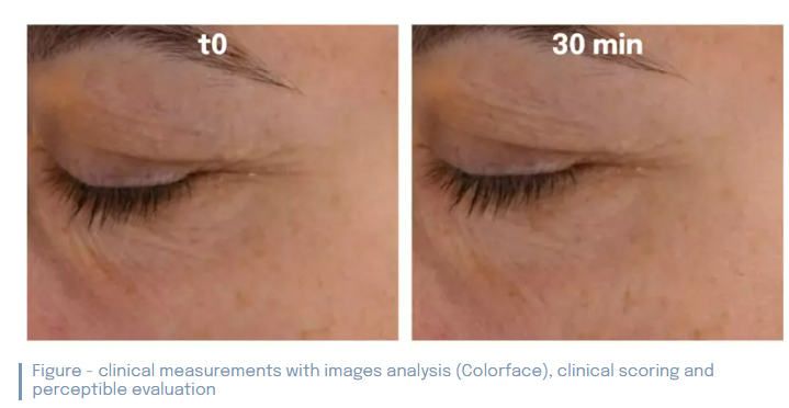 Seppic unveils new immediate skin benefits of Solagum™ AX, its natural ...